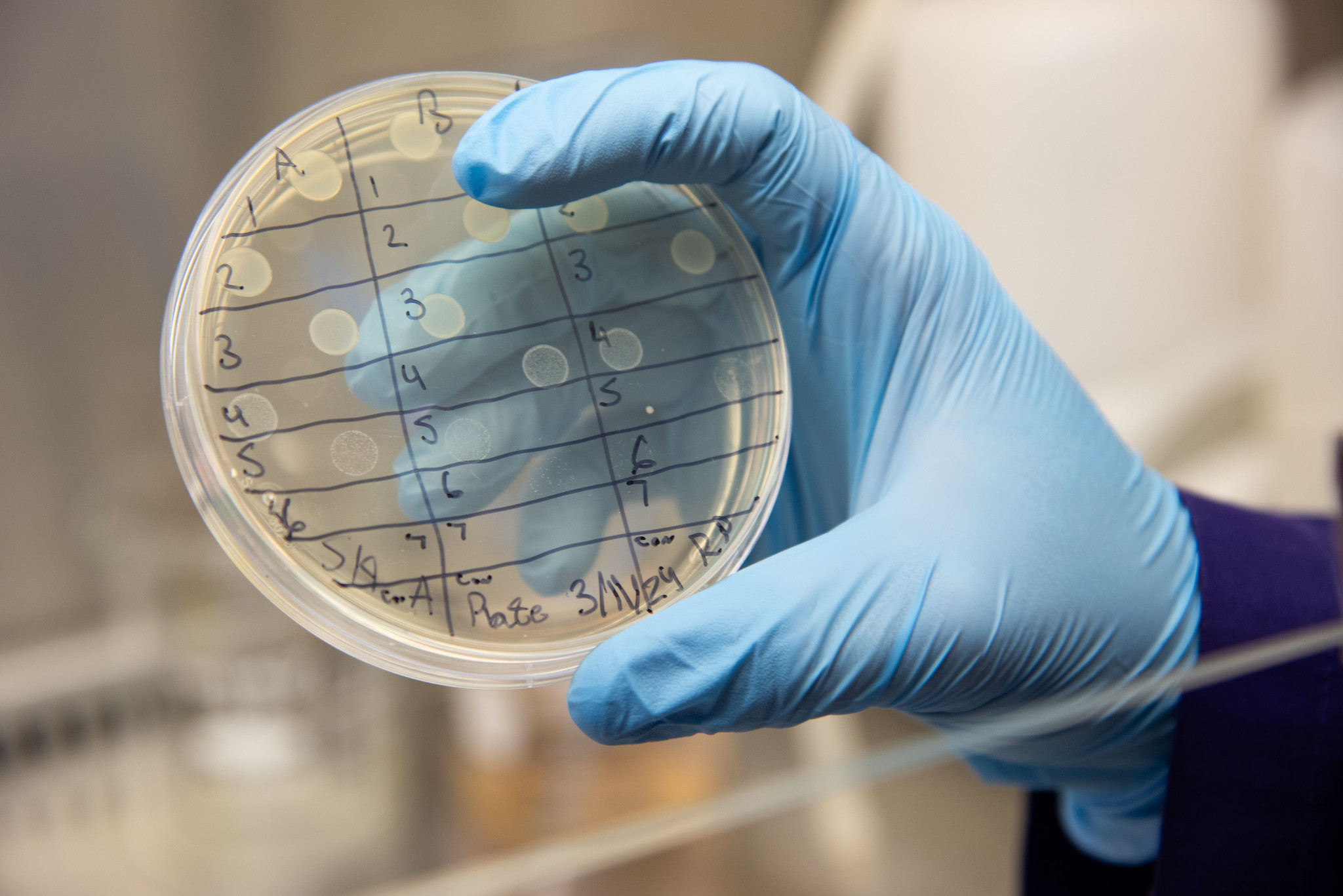 How Brucella bacteria find the sweet spot during infection ...